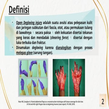 Revisi PPT Referat Open Degloving Injury.pptx