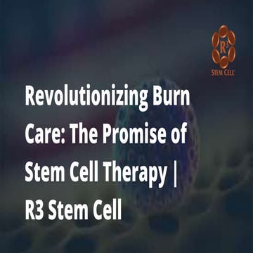 Revolutionizing Burn Care The Promise of Stem Cell Therapy R3 Stem Cell ...