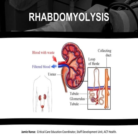Rhabdomyolysis | PPT