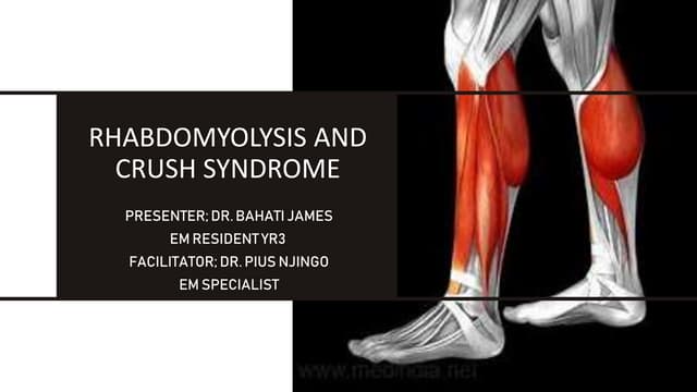 Crush syndrome PPT | PPTX