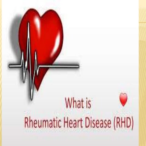 Rheumatic Heart Disease powerpoint for bio anatomy/physiology students ...