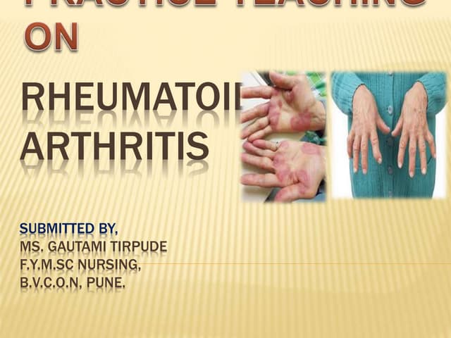 Rhematoid Arthritis Uploaded Ppt