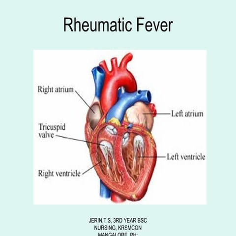 Rheumatic fever | PPT