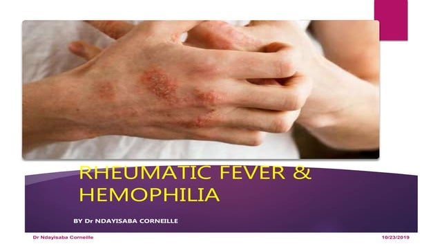 Acute rheumatic fever.ppt