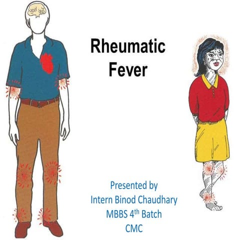 Rheumatic fever | PPTX
