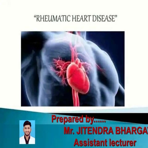 RHEUMATIC HEART DISEASE SLIDESHARE | PPTX