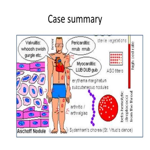 Rheumatic heart disease: Acute Rheumatic Fever | PPTX