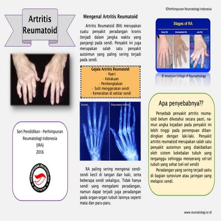 Rheumatoid-Arthritis.pdf