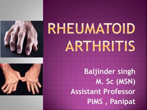 Rheumatoid Arthritis | PPT