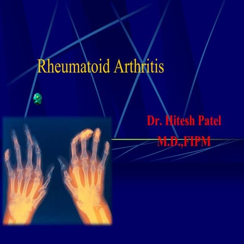 Rheumatoid arthritis | PPTX