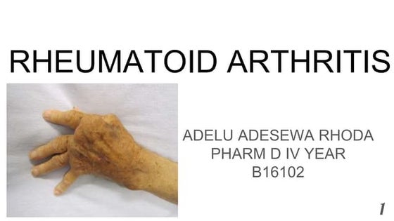 Rheumatoid arthritis ppt | PPT