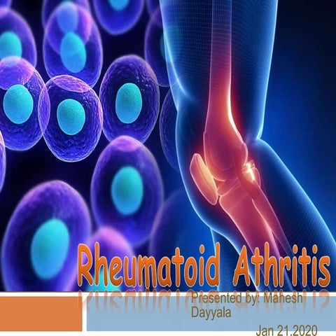 Rheumatoid arthritis | PPT