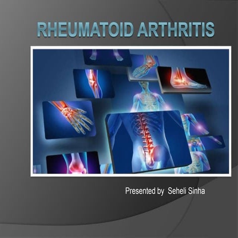Rheumatoid arthritis | PPTX