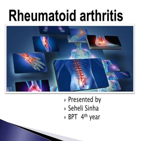 Rheumatoid arthritis final | PPT | Free Download