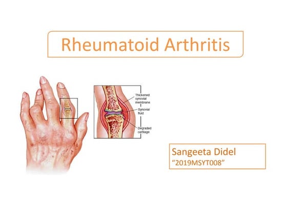 Pathophysiology of Rheumatoid arthritis | PDF | Bone and Joint ...