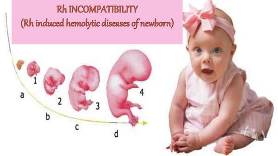 Rh Incompatibility I Hemolytic Disease of the Newborn | PPT