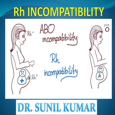 Rh incompatibility | PPTX