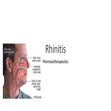 rhinitis.pptx