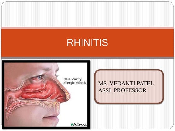 Vasomotor rhinitis and other rhinitis | PPTX
