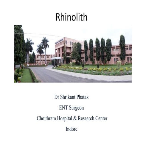 Rhinolith : Stone formation Nose | PPTX