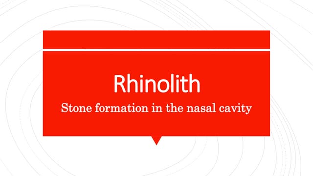 diagnostic nasal endoscopy | PPTX