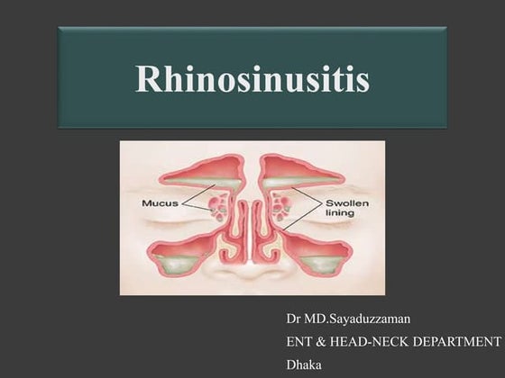 Rhinosinusitis.pptx