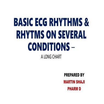 basic ECG rhythms & rhythms on different conditions | PPT