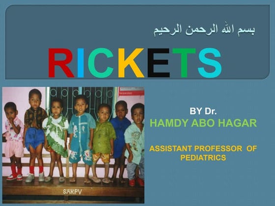 The boot shaped heart sign | PPT