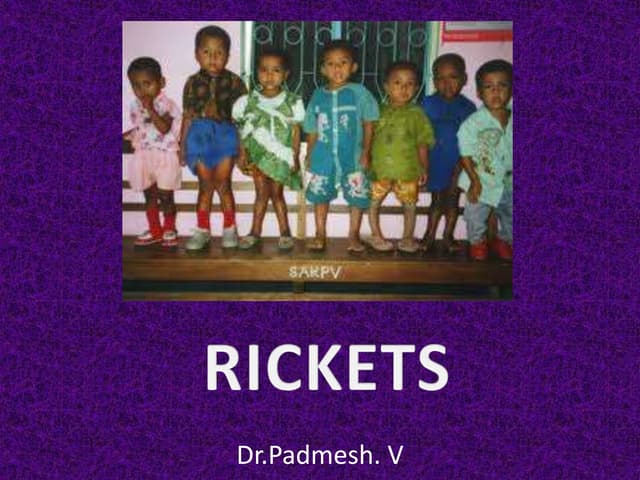 Imaging in rickets | PPTX | Bone and Joint Conditions | Diseases and ...
