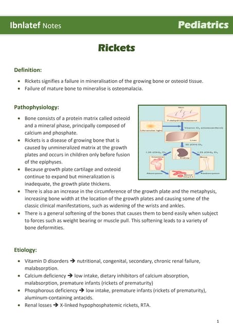 RICKETS : introduction, clinical features, Diagnosis, PT mangement | PPT