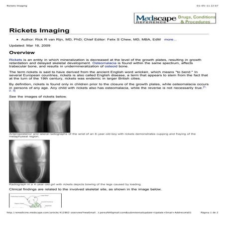 Imaging in rickets | PPTX