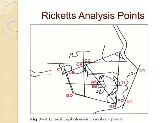 Ricketts analysis | PPTX | Dental Health | Diseases and Conditions