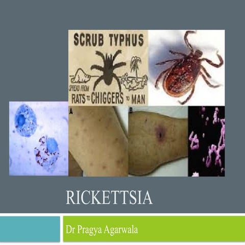 Rickettsia for MBBS and nursing lecture.pptx