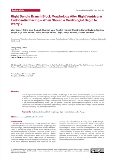 RBBB with STEMI | PPT