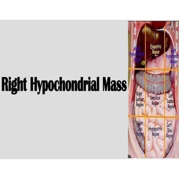 Right Hypochondrial Mass.BS Surgery.pptx
