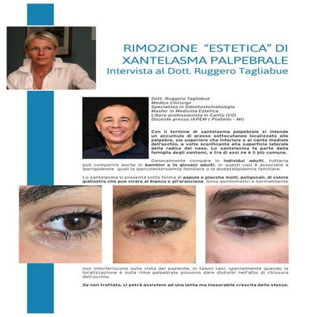 Rimozione estetica di Xantelasma palpebrale | PDF