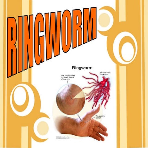 Ringworm | PPT