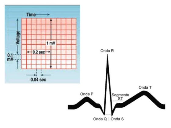 Eje Elctrico Del Complejo Qrs Como Leer Un Electrocardiograma