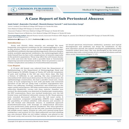 A Case Report of Sub Periosteal Abscess | Crimson Publishers | PDF