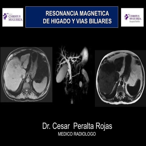 Colangiografia por Resonancia Magnetica
