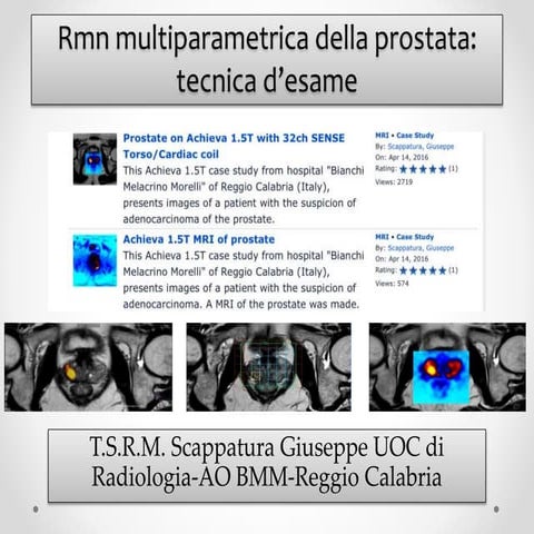 Multiparametric MRI for prostate cancer,executed by Giuseppe Scappatura ...