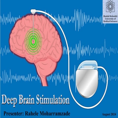 Deep Brain Stimulation (DBS) and targets.ppt
