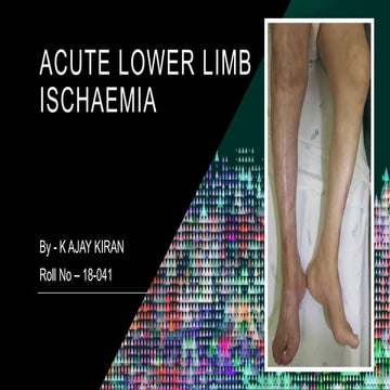 Acute Lower Limb Ischaemia.pptx