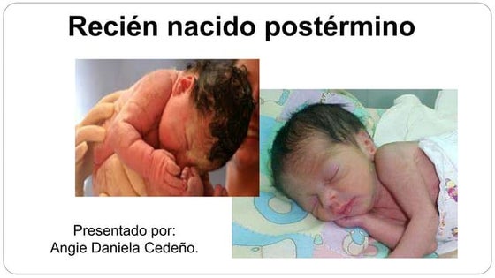 Recien Nacido Postermino Diagnostico Y Manejo Pptx