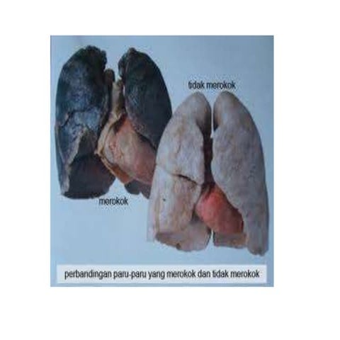 Rokok alkohol | PPTX