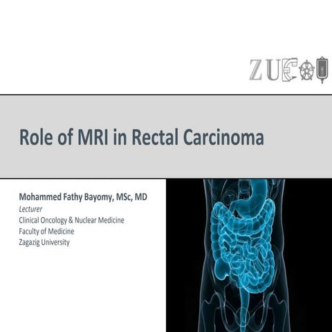 Role of mri in rectal carcinoma | PPTX