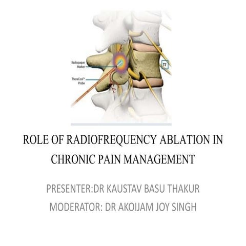 Role of radiofrequency ablation in pain management | PPTX