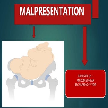 Malpresentation | PPT