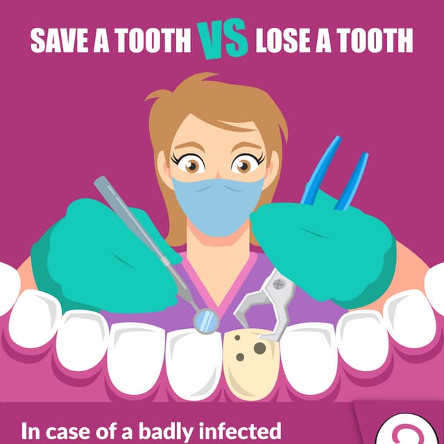 Root Canal Treatment or Tooth Extraction [Survey Stats Infographic ...