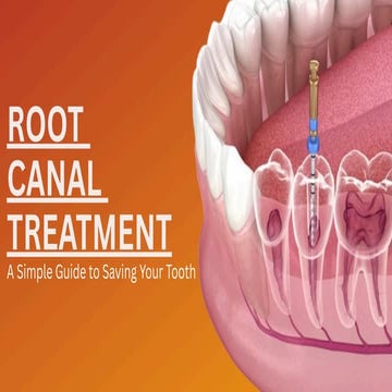 Complete Overview of Root Canal Procedure | PDF